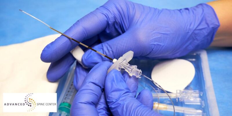 Cervical Epidural Steroid Injection Frisco | Advanced Spine Center