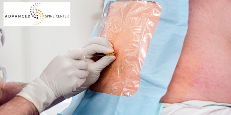 Lumbar Epidural Steroid Injection Frisco | Advanced Spine Center