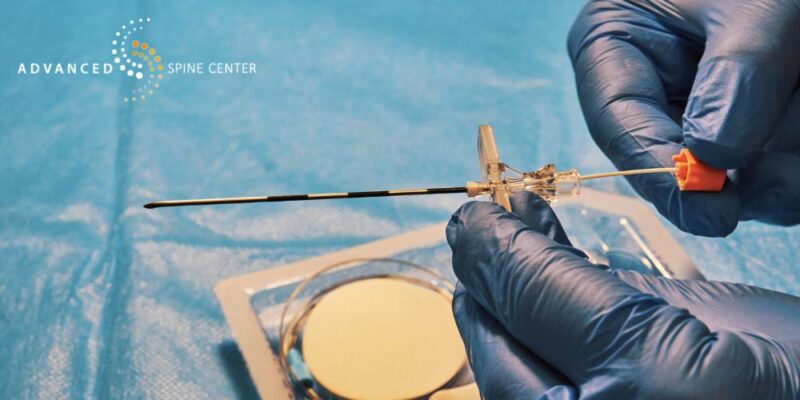 Lumbar Epidural Steroid Injection McKinney, Texas | Dr. Courtney