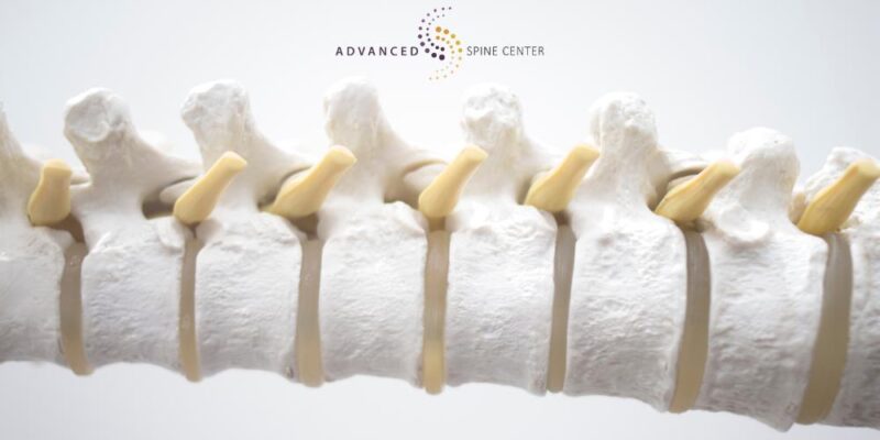 Lumbar Microdiscectomy Surgery in McKinney | Dr. Stephen Courtney