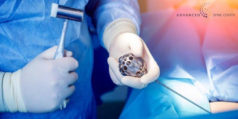 Lumbar Microdiscectomy Surgery Allen, TX | Dr. Stephen Courtney