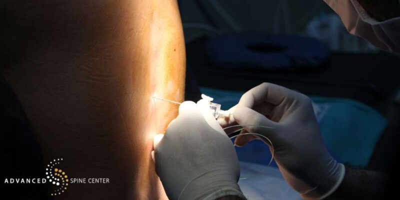 Lumbar Epidural Steroid Injection Without Contrast | Plano | Dr. Courtney