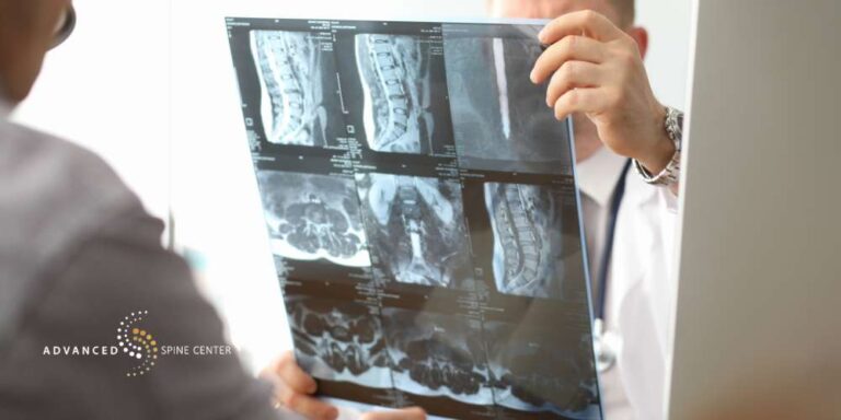 What Are the Final Stages of Spinal Stenosis? | Dr. Stephen Courtney