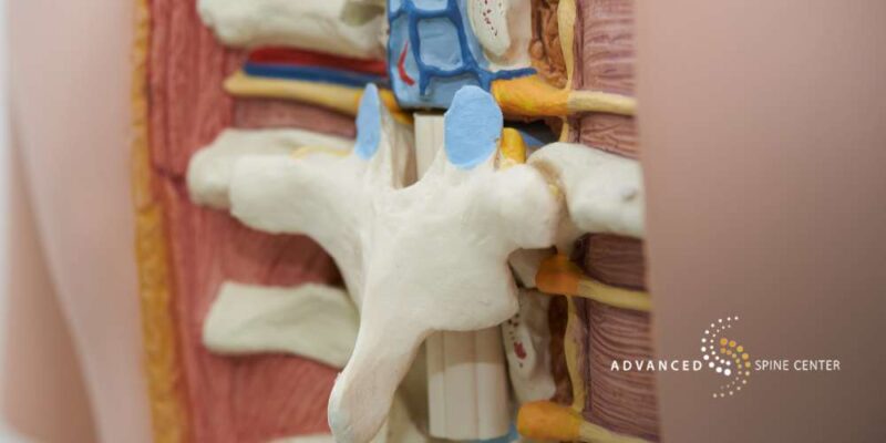 Thoracic Medial Branch Block in Plano | Advanced Spine Center