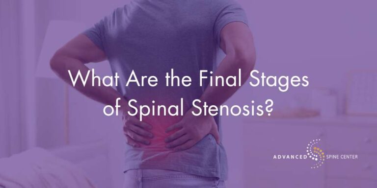 What Are the Final Stages of Spinal Stenosis? | Dr. Stephen Courtney