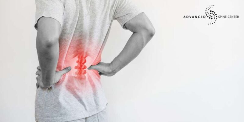 What Is Disc Desiccation? | Advanced Spine Center | Plano, TX