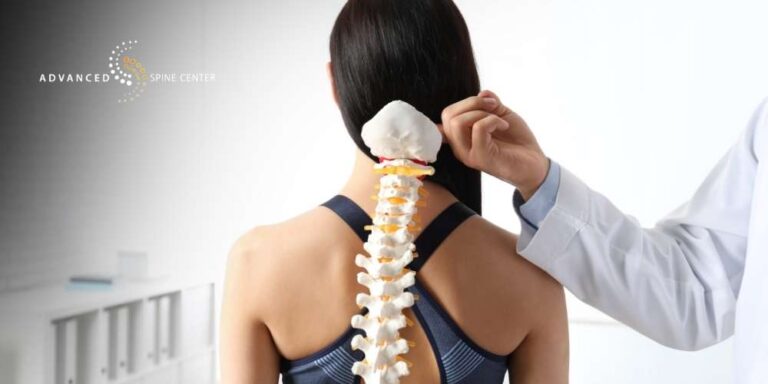 Kyphosis Surgery in Plano, TX | Advanced Spine Center