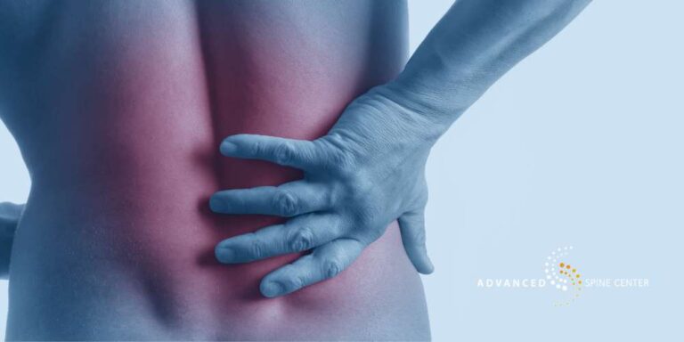 When Should I Be Worried About Back Spasms? | Advanced Spine Center
