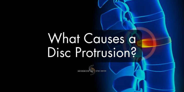 What Causes a Disc Protrusion? | Advanced Spine Center