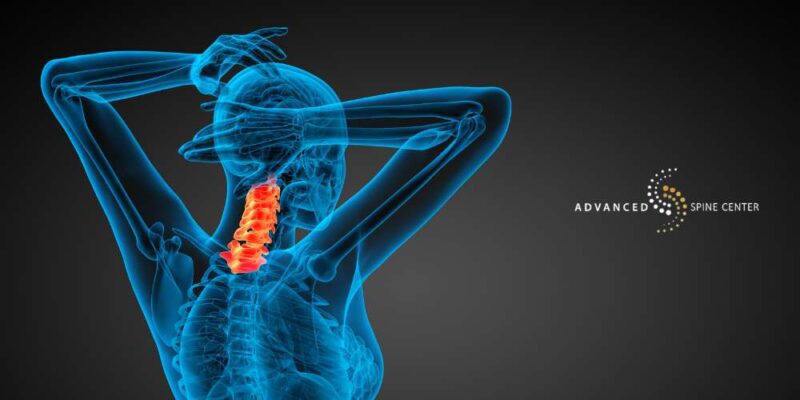 Hemilaminectomy Surgery in Plano, TX | Advanced Spine Center