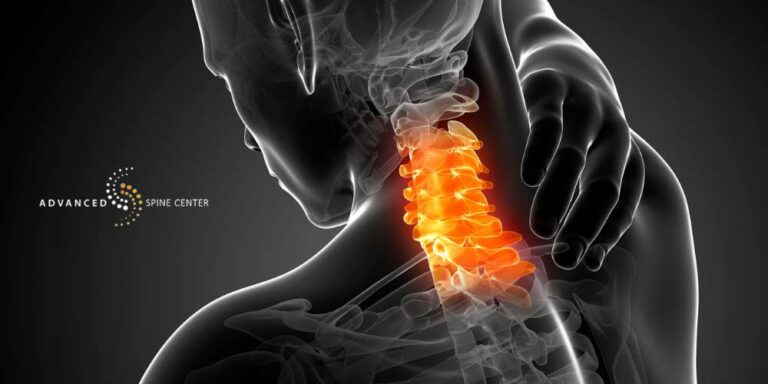Cervicogenic Headache Treatment | Advanced Spine Center