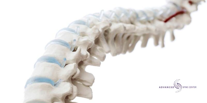 Vertebroplasty Surgery in Plano, TX | Advanced Spine Center