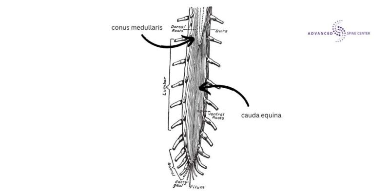 Cauda Equina Syndrome Treatment in Plano, TX