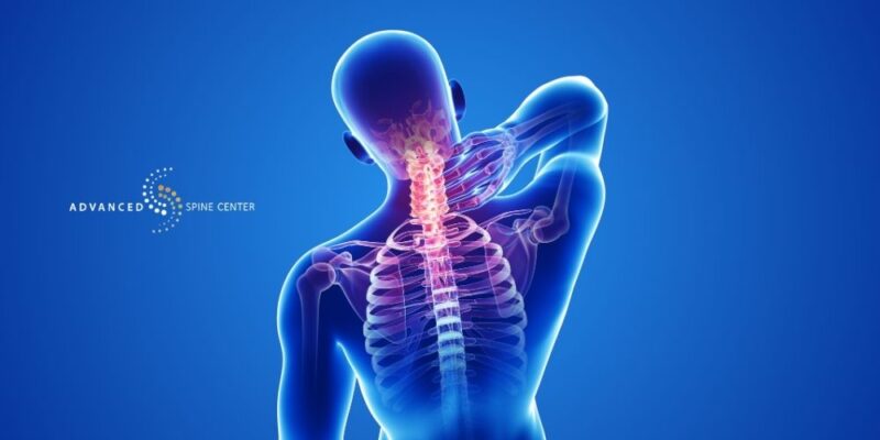 ACDF Surgery | Plano, TX | Dr. Stephen P. Courtney