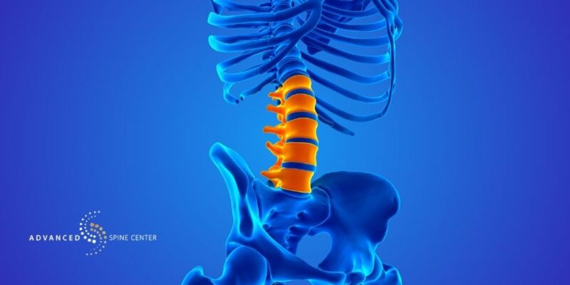 What To Do After A Thrown Out Back | Advanced Spine Center